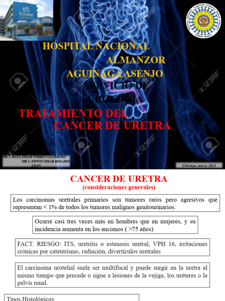 Cancer de Uretra Final | Descargar gratis PDF | Metástasis | Neoplasias