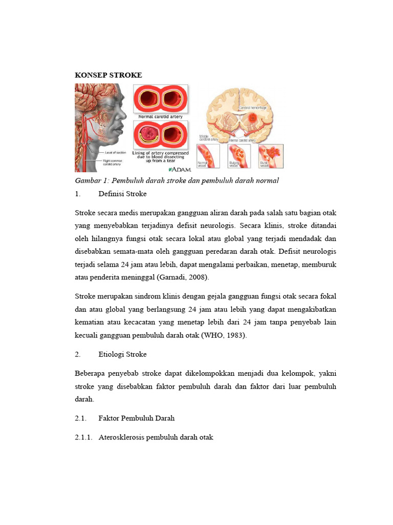 Konsep Stroke | PDF