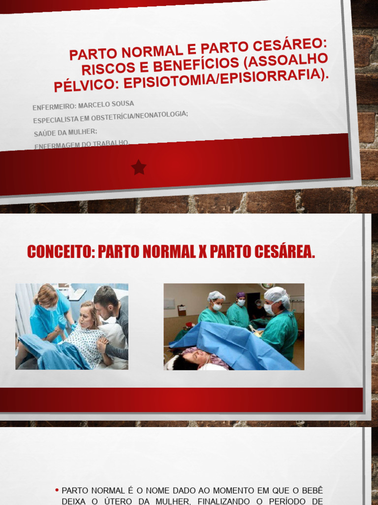Riscos e Benefícios: Parto Normal vs Cesárea | PDF | Parto | Cesariana