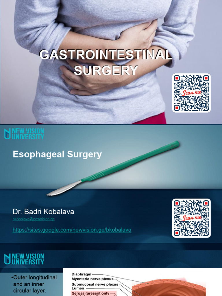 Gastro Surgery Ppts | PDF | Esophagus | Gastroesophageal Reflux Disease