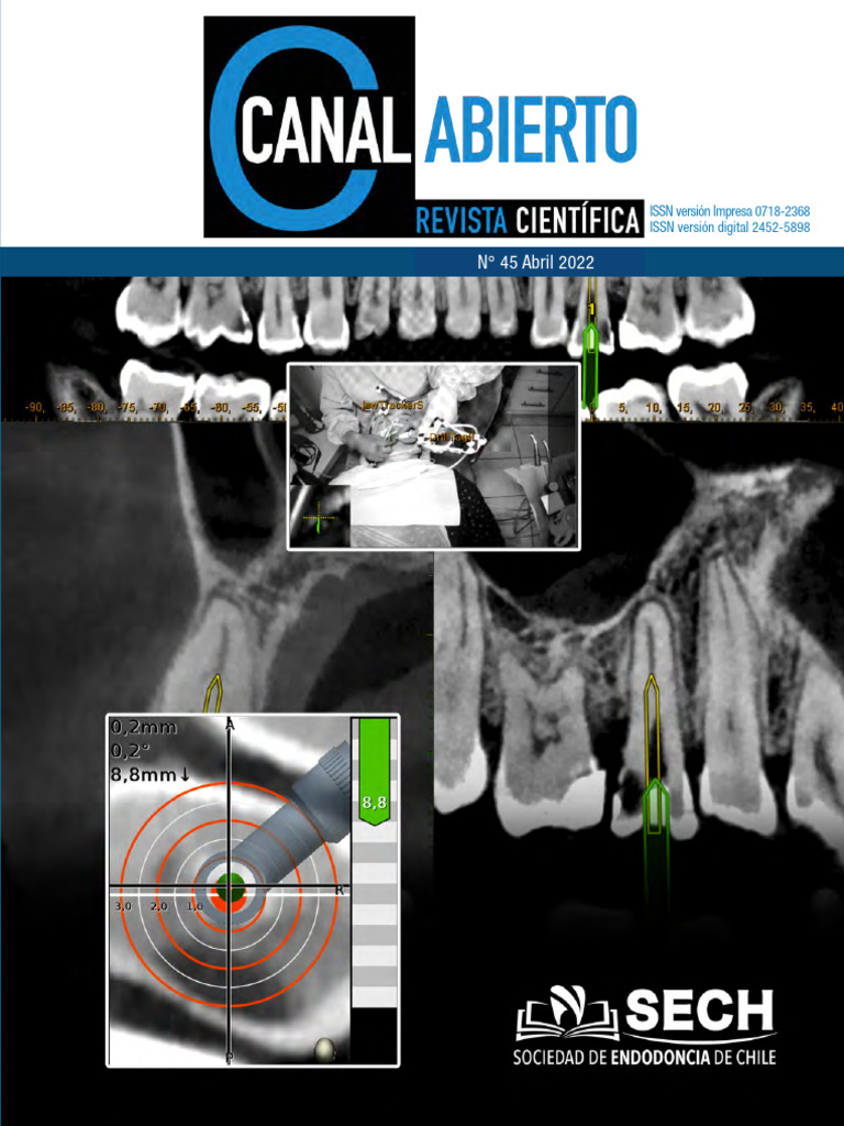 Revista Canal Abierto 45 - Abril 2022 J | Descargar gratis PDF | Diente ...