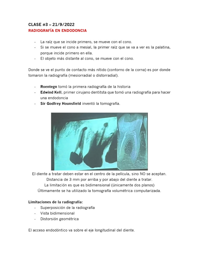 Clase #3 - Radiografia en Endodoncia LENIN | PDF | Ct Scan | Especialidades Medicas