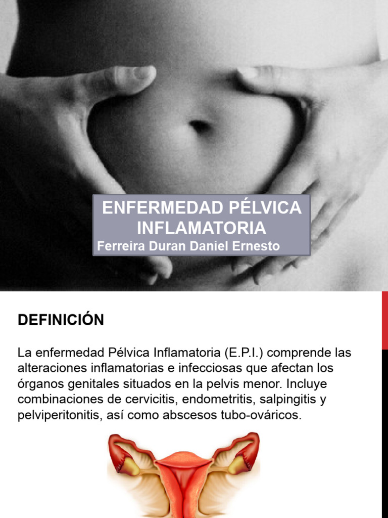 Enfermedad Inflamatoria Pelvica (EIP) | PDF | Infección transmitida sexualmente | Enfermedades y ...
