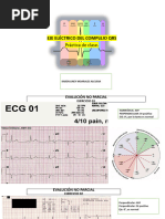 Ángulo de Louis | PDF | Tórax | Anatomía humana
