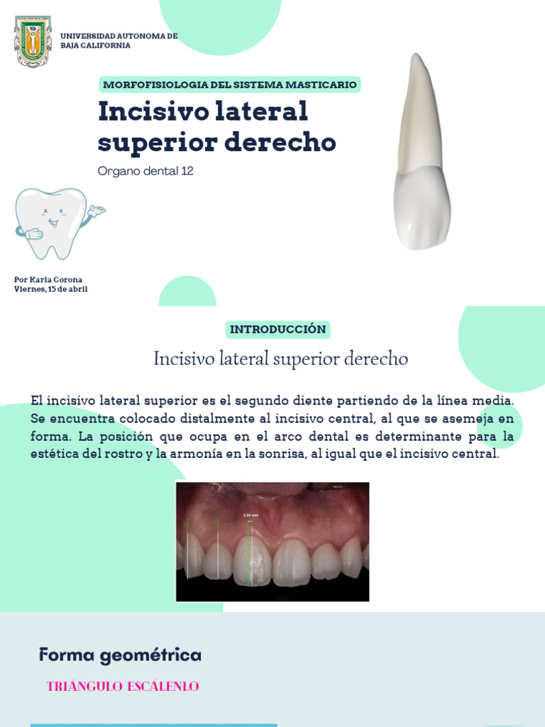 Morfología del Incisivo Lateral Superior | PDF | Anatomia dental | Diente