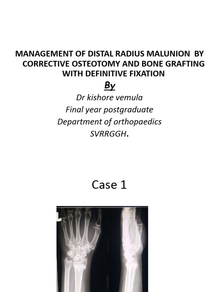 S-Distal Radius Malunion, Correction | PDF | Skeletal System ... S-Distal Radius Malunion, Correction | PDF | Skeletal System ...