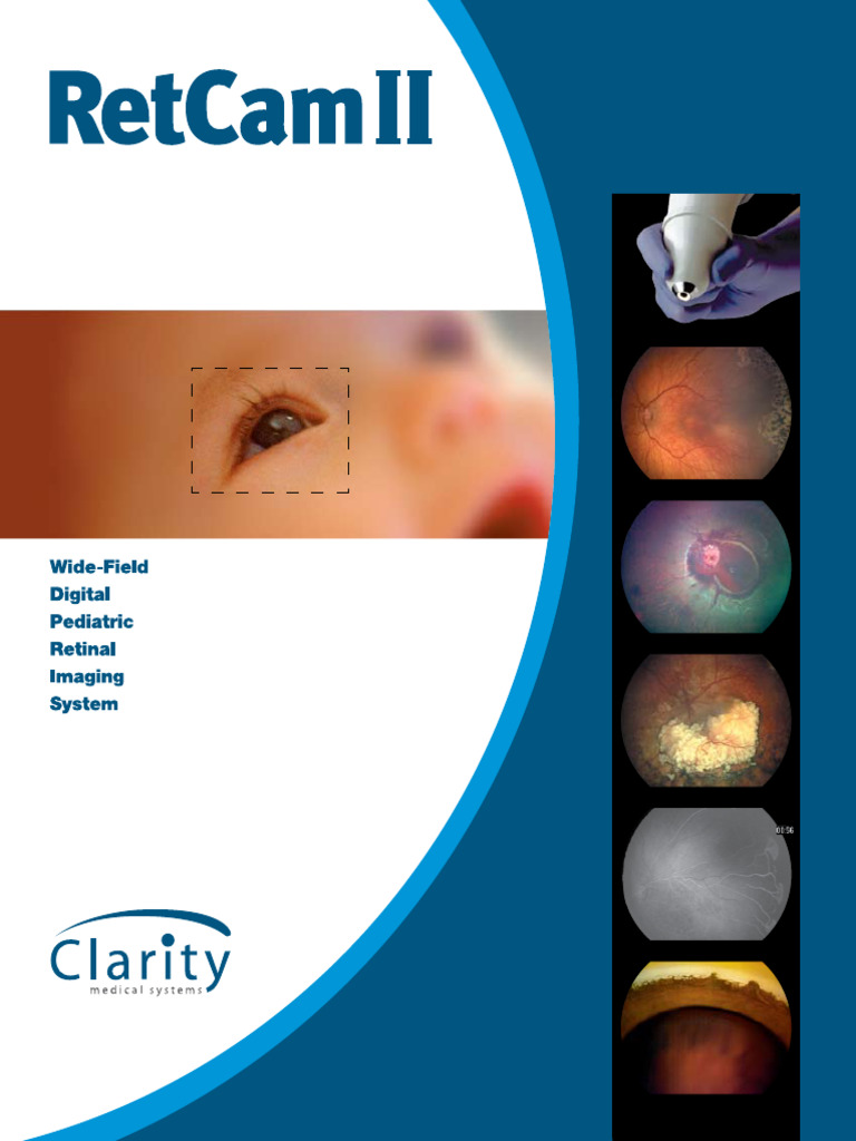 Ret Cam | PDF | Retina | Field Of View