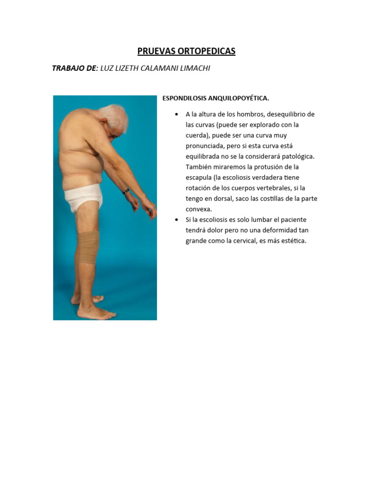 Pruebas Ortopédicas: Signos de Lasègue y Bragard | PDF | Rodilla | Codo