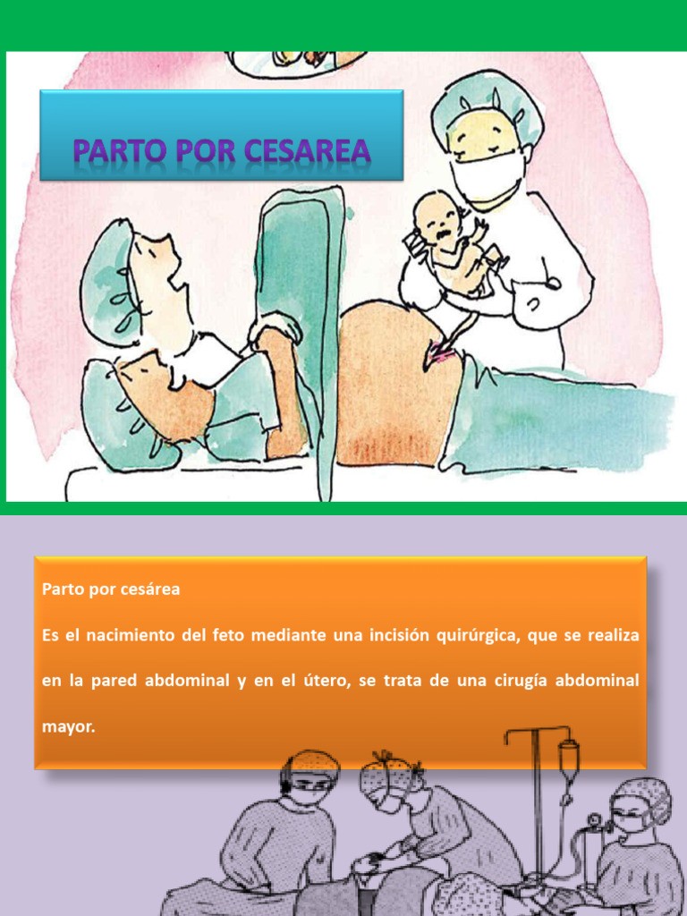 Proceso y Cuidados en Cesárea | PDF | Parto | La leche materna