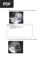 Rhese Method for Orbit X-Ray Positioning | PDF