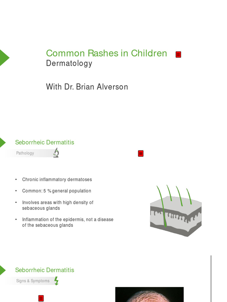 Slides CommonRashesinChildren Pediatrics | PDF | Dermatitis | Cutaneous ...