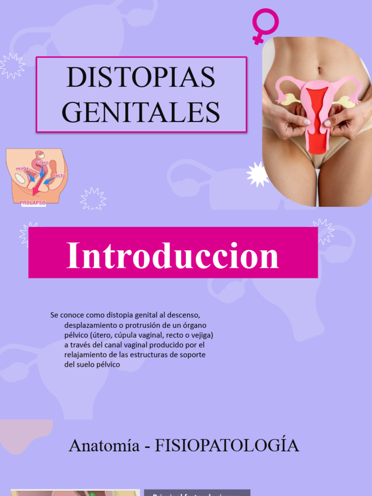Prolapso Genital: Causas y Tratamientos | PDF | Vagina | Útero