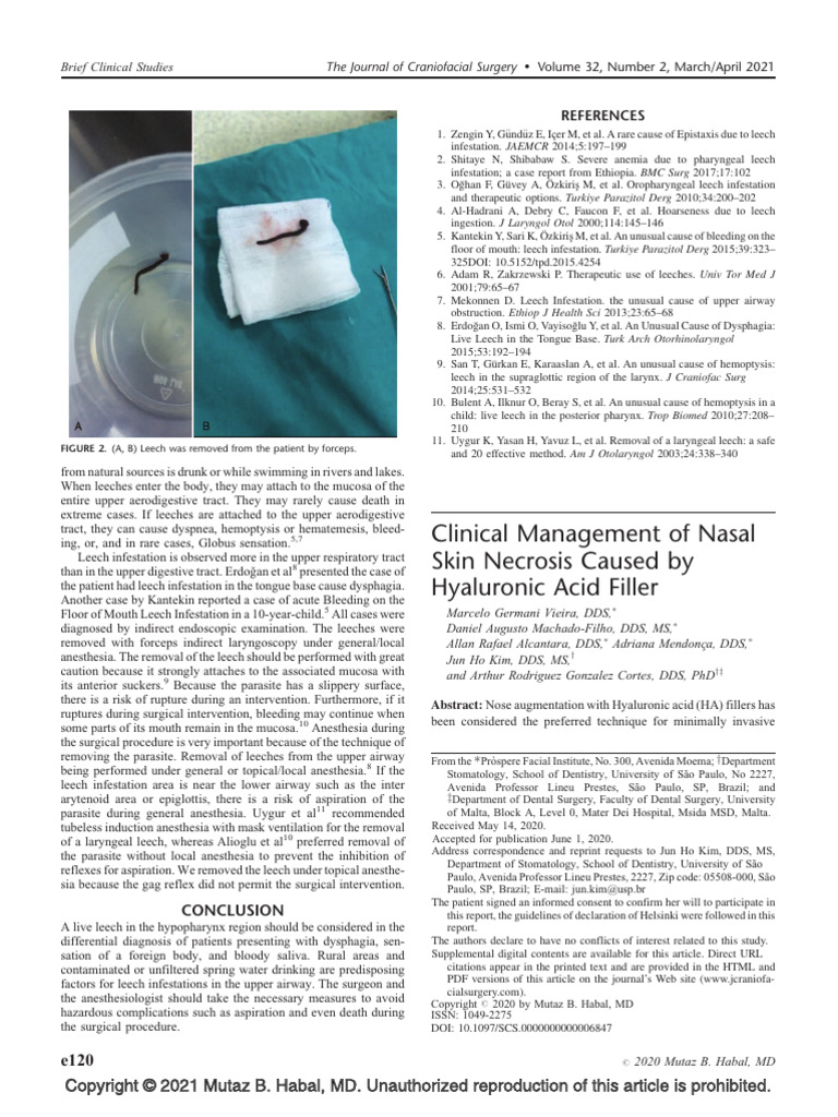 Clinical Management of Nasal Skin Necrosis Caused.95 | PDF | Surgery ...