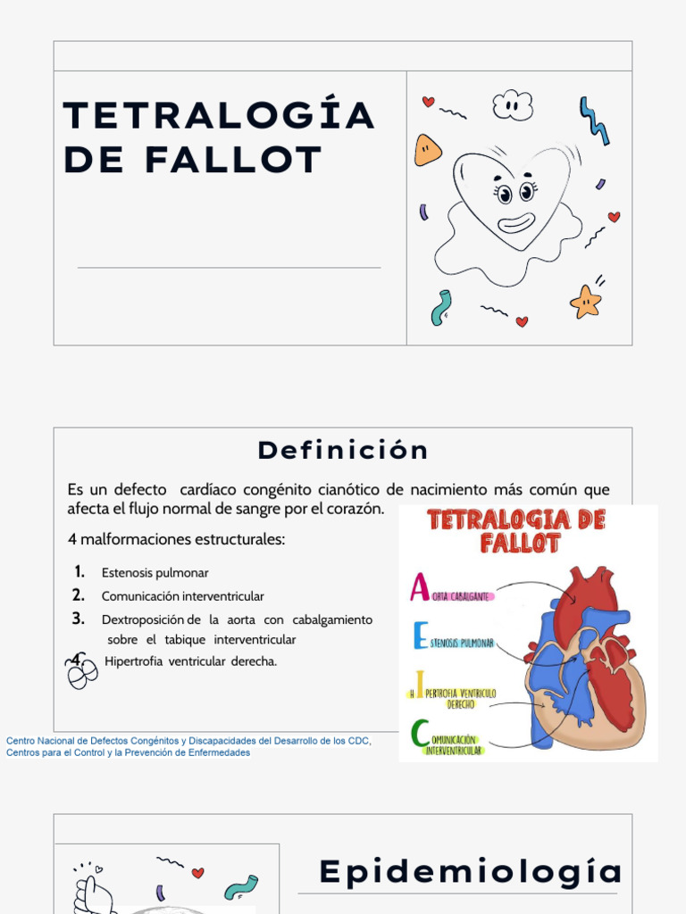 Diagnóstico y Tratamiento de Tetralogía de Fallot | PDF | Corazón ...