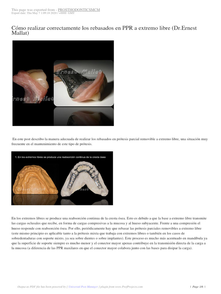Cómo Realizar Correctamente Los Rebasados en PPR A Extremo Libre (DR ...