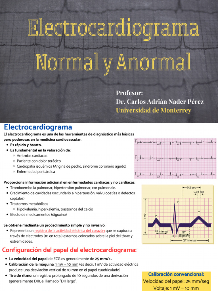 Electrocardiograma Normal | PDF
