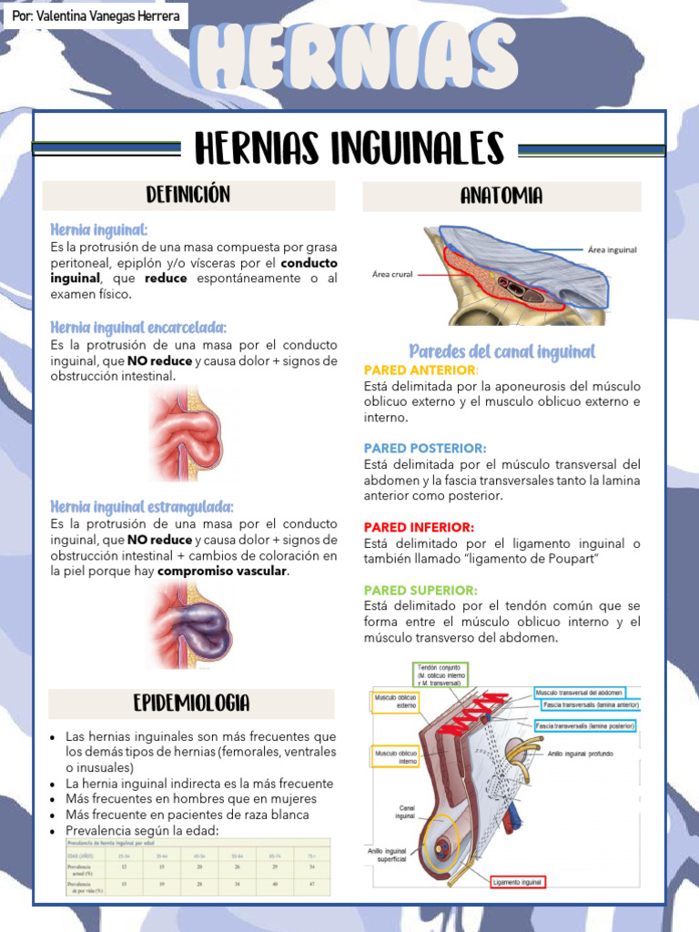 Guía sobre Hernias Inguinales | PDF | Abdomen | Anatomía