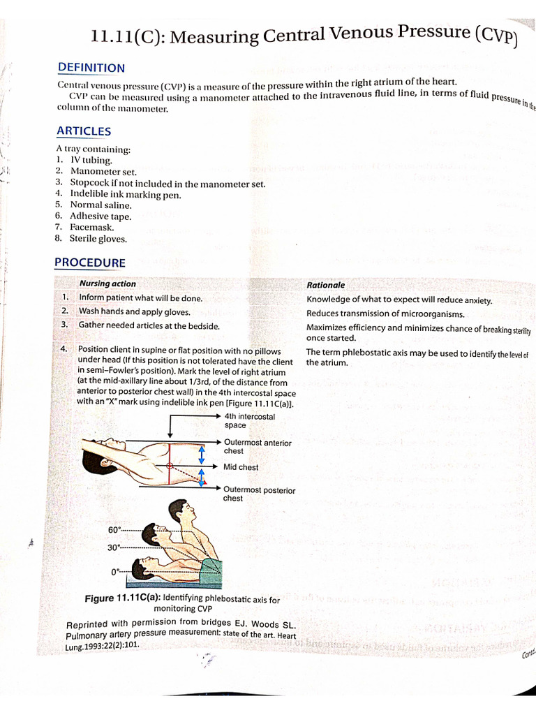 CVP Monitoring | PDF