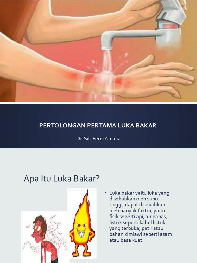 Presentasi Luka Bakar | PDF