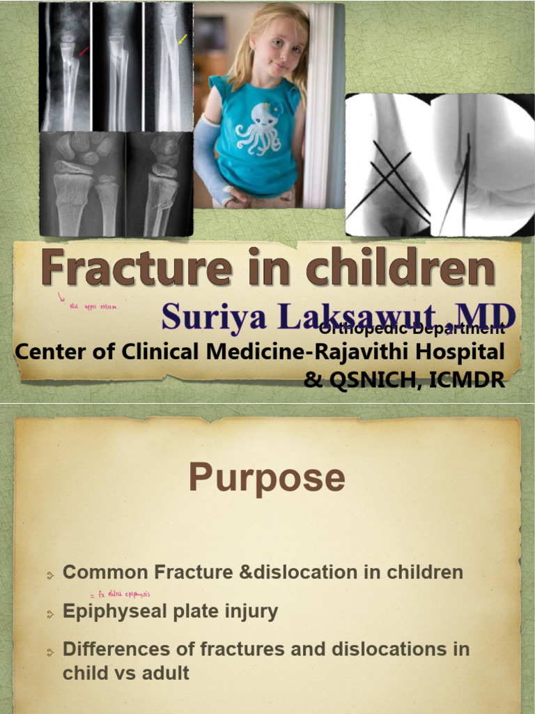 13 - Fracture in Children | PDF | Musculoskeletal System ...