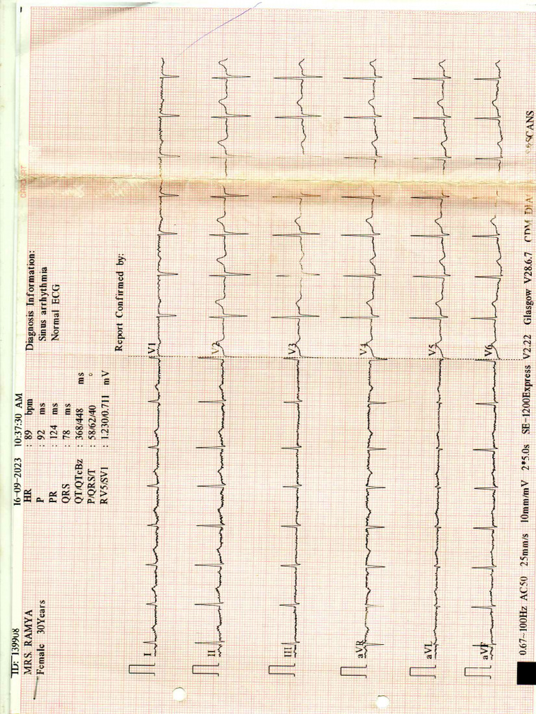 ECG Report | PDF
