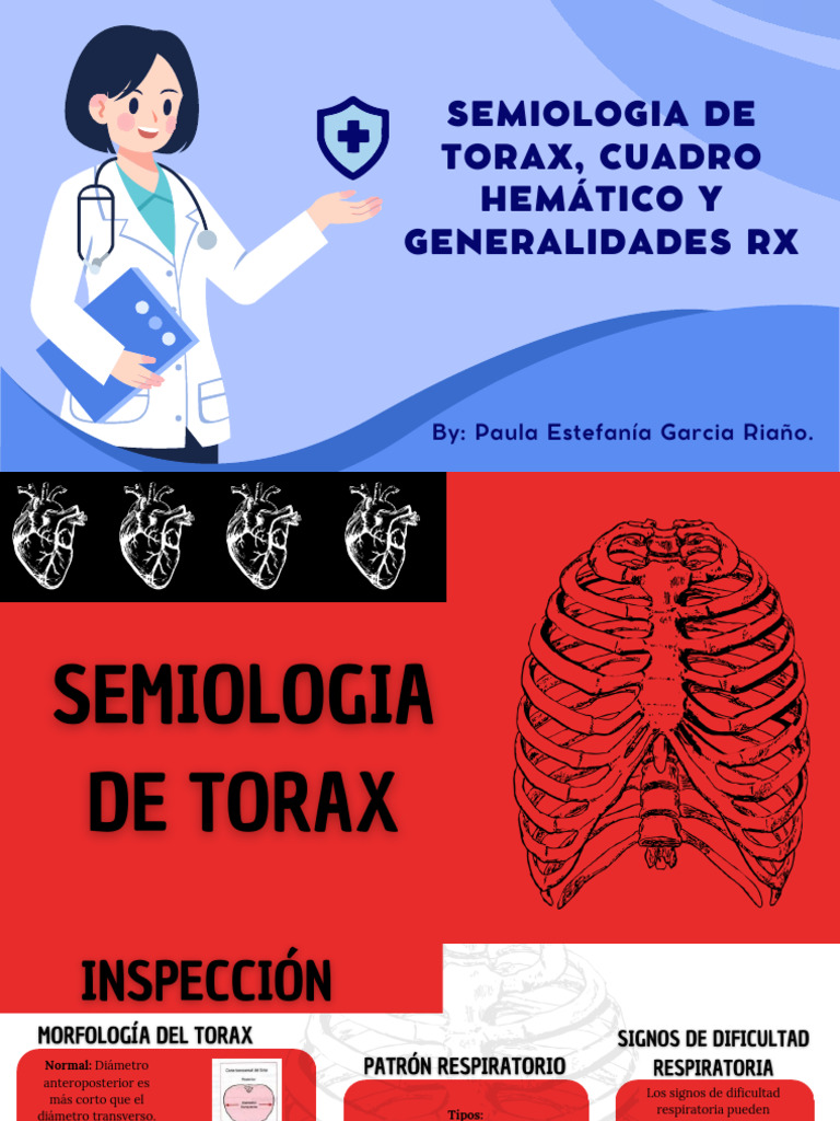 Semiología de Tórax, RX y Hemograma | PDF | Leucocito | Sangre