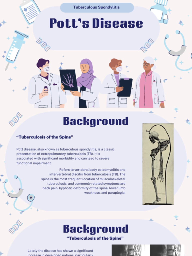 Potts Disease | PDF | Tuberculosis | Vertebral Column