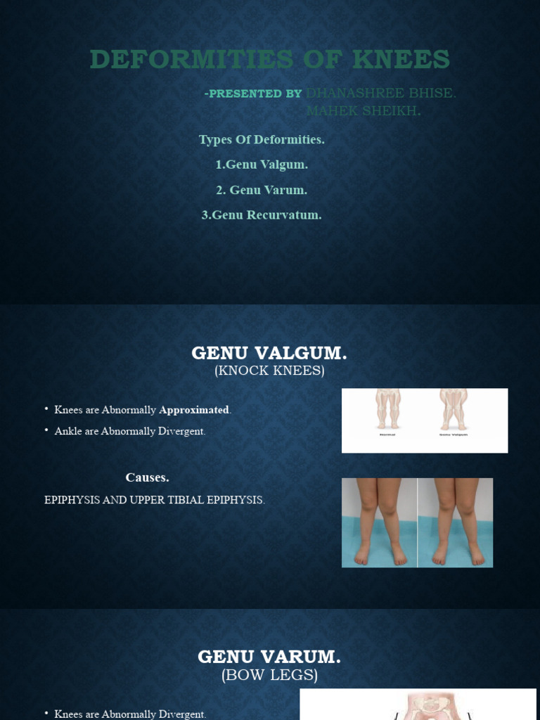 Knee Deformities: Types and Causes | PDF | Wellness