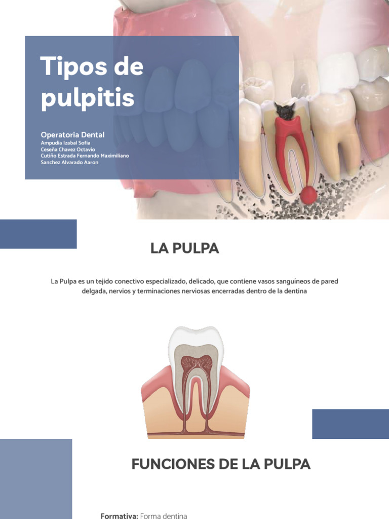 Tipos de Pulpitis | Descargar gratis PDF | Anatomia dental | Medicina
