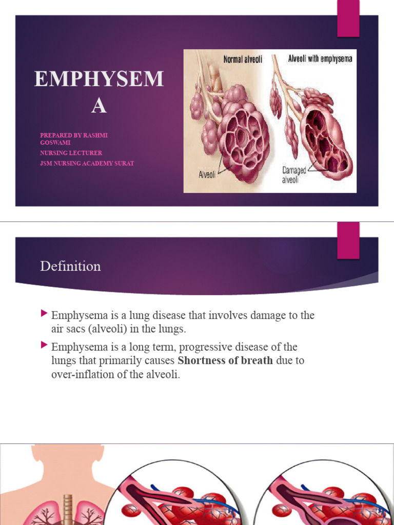 Emphysema | PDF