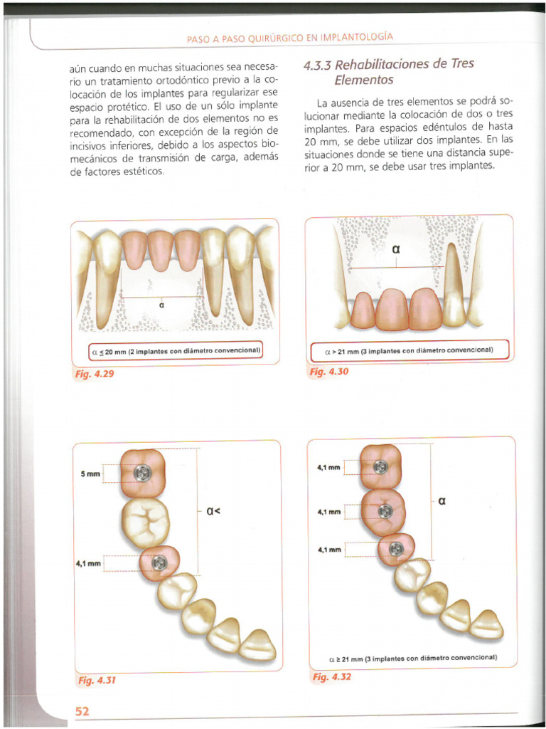 Dientes | PDF