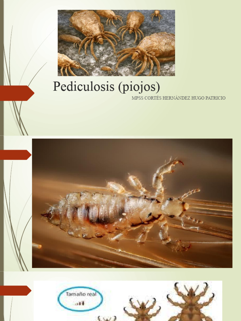 Pediculosis (Piojos) | PDF | Salud y bienestar