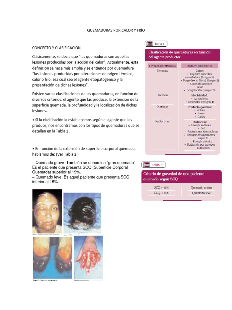 9 QUEMADURAS POR CALOR Y FRÍO | PDF | Quemar | Edema