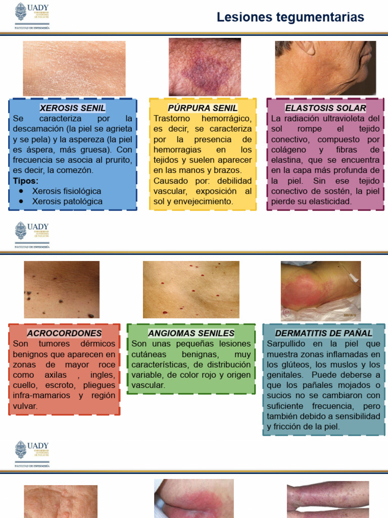 Lesiones cutáneas en personas mayores | PDF | Piel | Especialidades Medicas