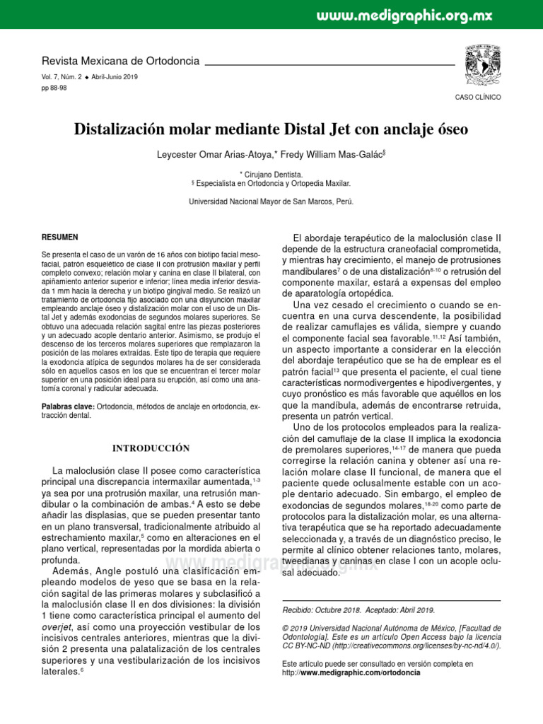 Distalización Molar Mediante Distal Jet Con Anclaje Óseo: Revista ...