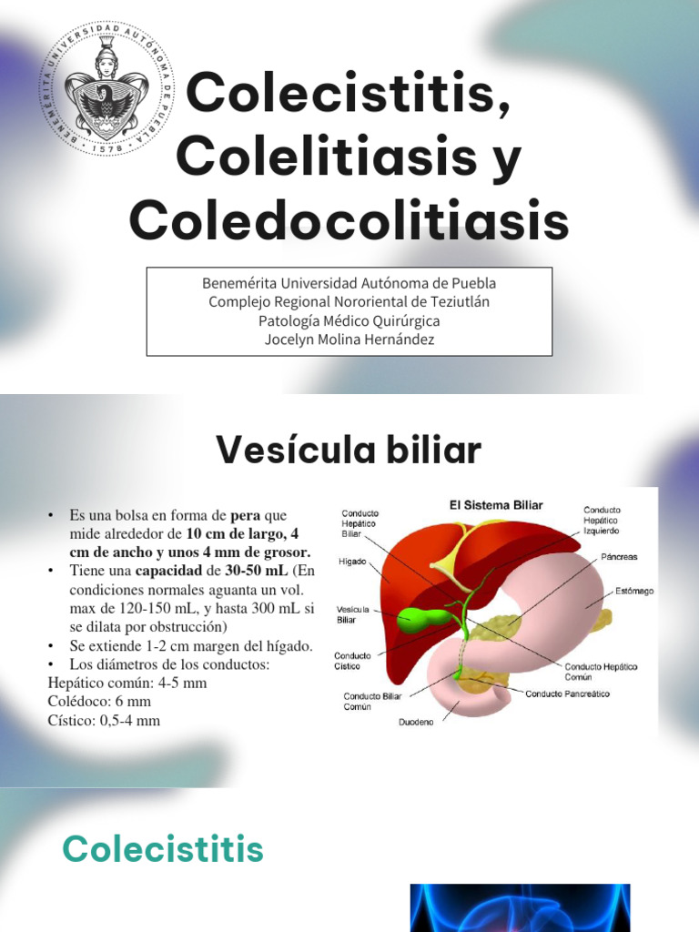 Colecistitis, Colelitiasis y Coledocolitiasis | PDF | Vesícula biliar ...