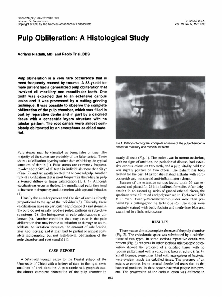 Pulp Obliteration - A Histological Study | PDF | Dentin | Tooth