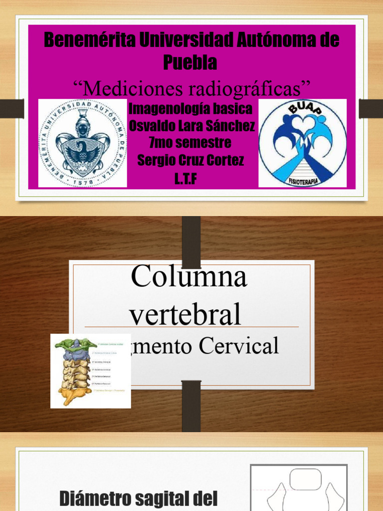Mediciones Radiograficas EXPO | PDF | Vértebra | La columna vertebral