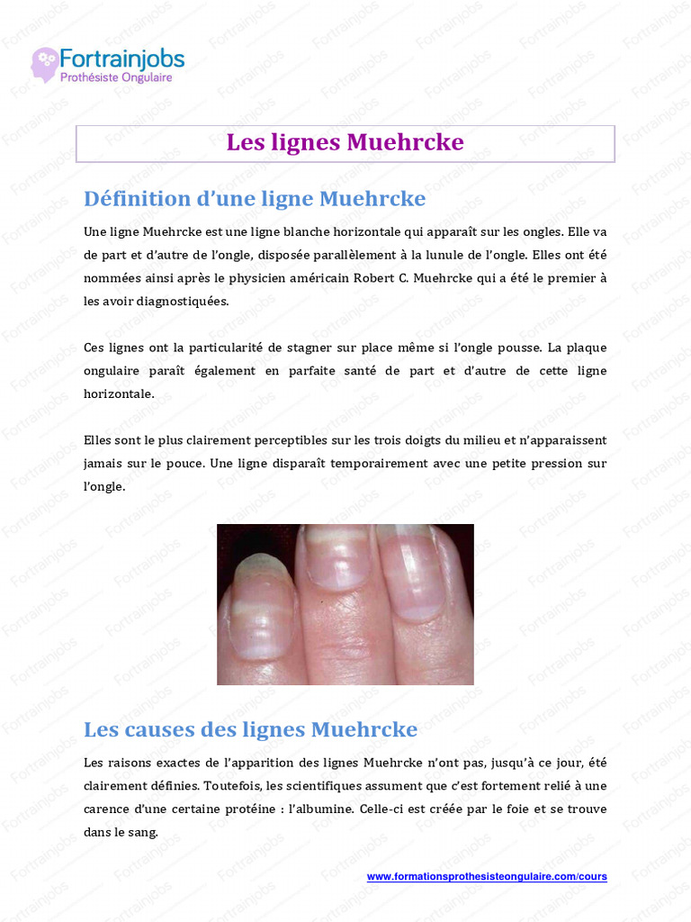 Maladies de L Ongle Les Lignes de Muehrcke | PDF