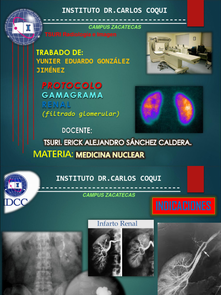 Protocolo de Gammagrama Renal en Zacatecas | PDF