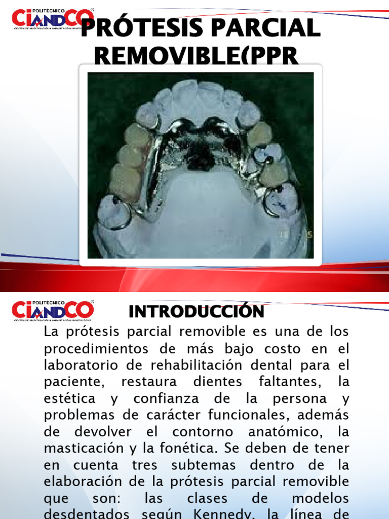 Protesis Parcial Removible (PPR) 1 | PDF | Diente | Boca
