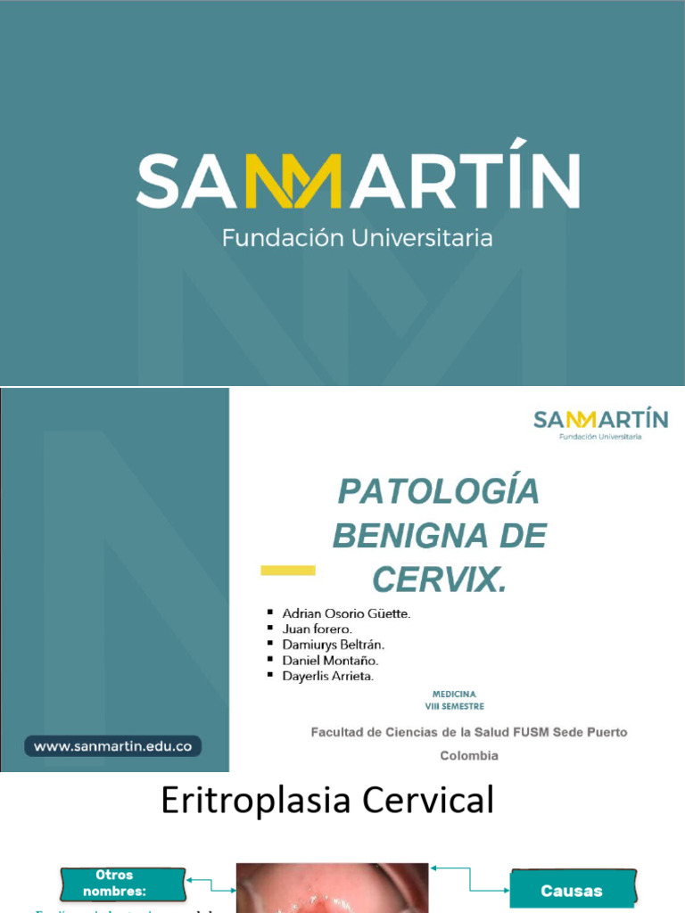 LESIONES BENIGNAS DE CERVIX | PDF | Vagina | Biopsia