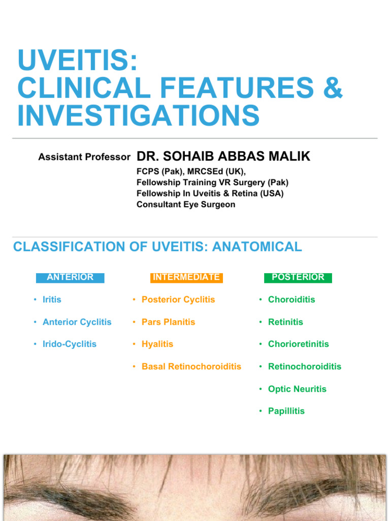 Ant Int Post Uveitis | PDF | Clinical Medicine | Vision