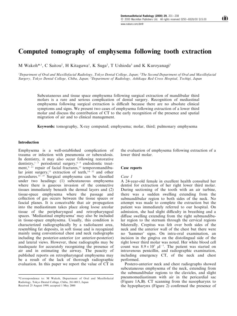 Computed Tomography of Emphysema Following Tooth Extraction | PDF ...