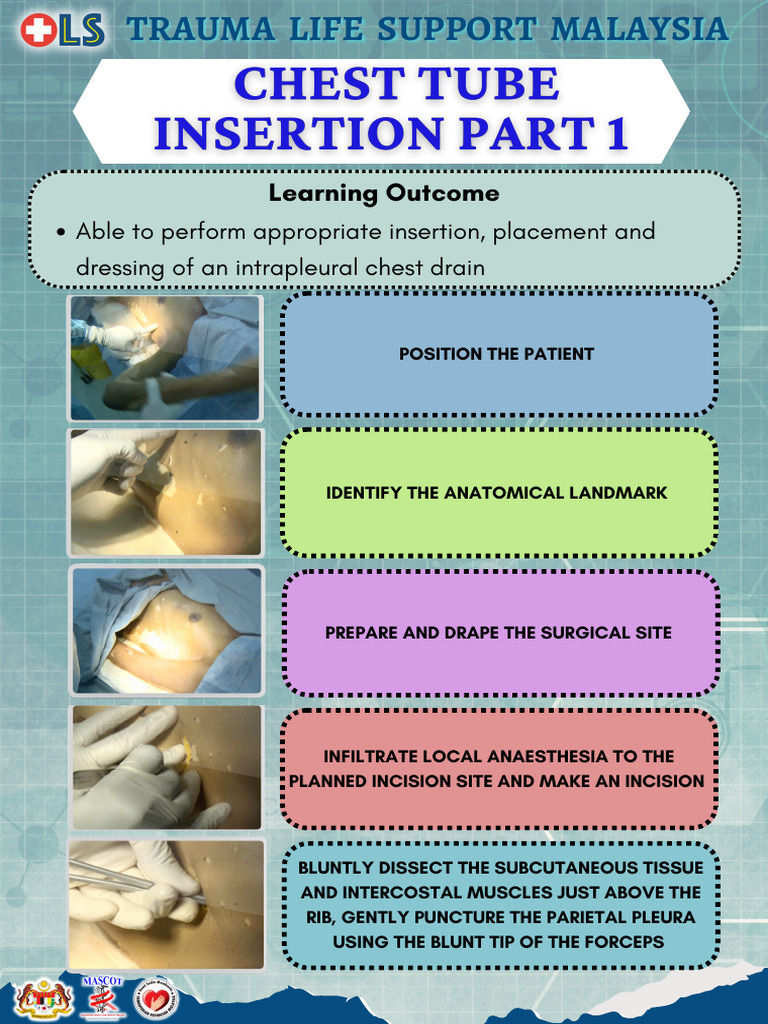 Chest Drain Procedure Guide | PDF