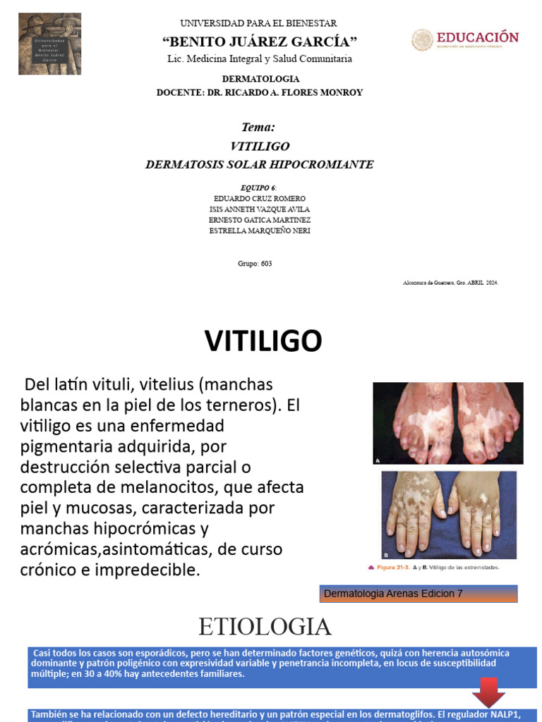Vitiligo: Causas, Diagnóstico y Tratamiento | PDF | Medicina CLINICA | Especialidades Medicas