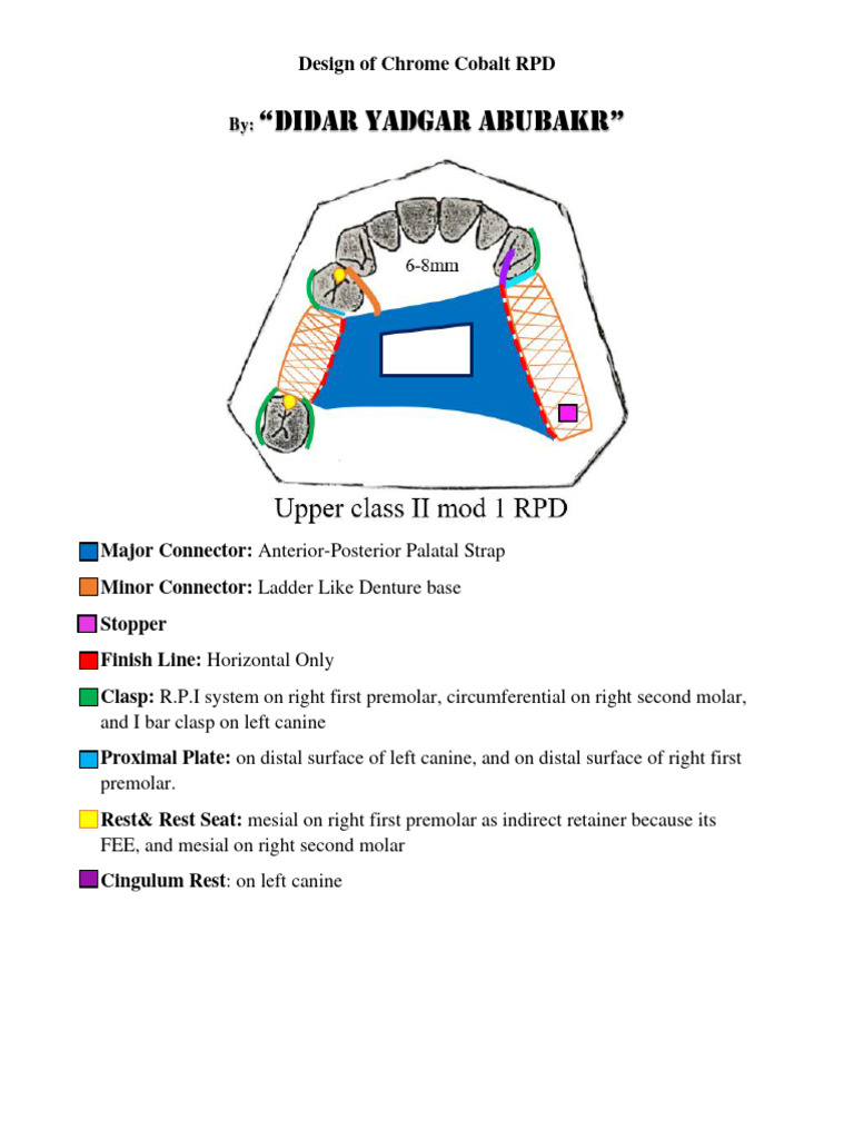 Design of Chrome Cobalt RPD | PDF | Dental Anatomy | Dentistry