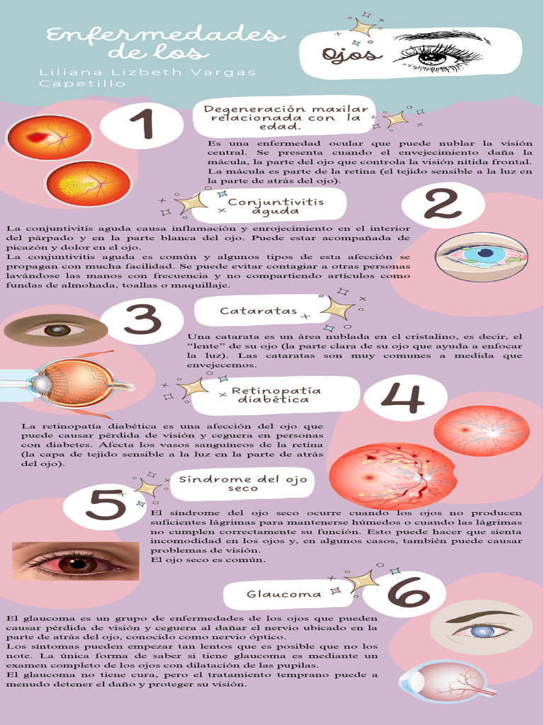 Enfermedades Del Ojo. | PDF | Ojo humano | Medicina