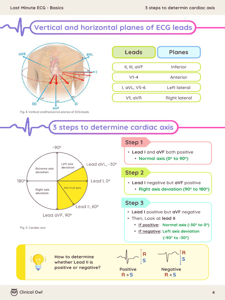 Clinical Owl ECG Basics Preview | PDF | Electrocardiography | Cardiovascular Physiology