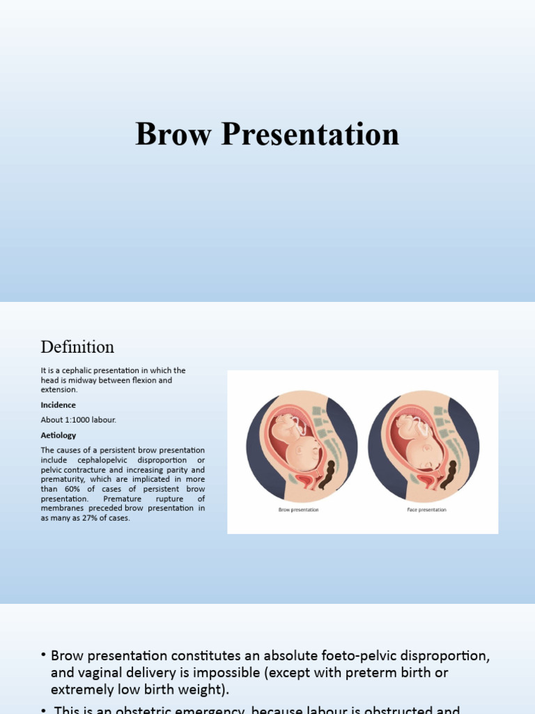 Brow Presentation | Download Free PDF | Childbirth | Medical Specialties